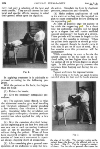 Osteopathic Treatment Of Inguinal Hernia – Holistic Hernia Remediation